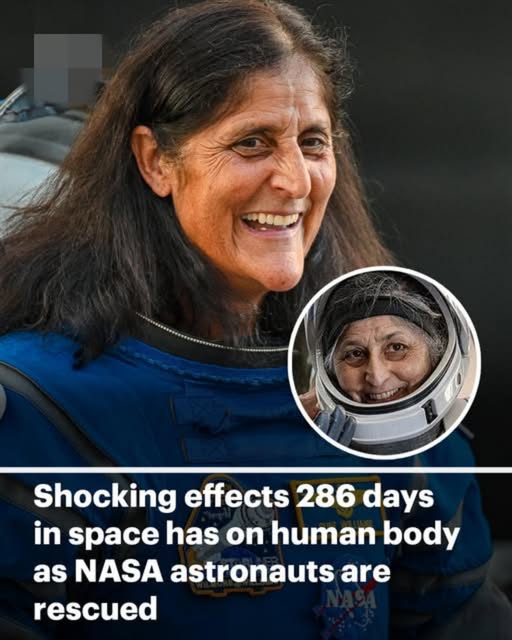 The shocking things 286 days in space does to a human body: As rescued ...